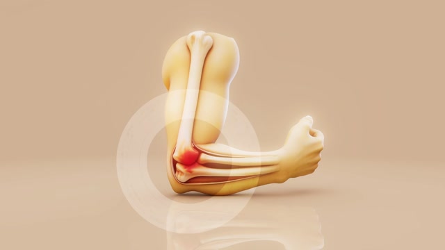 Elbow Animation Stock Footage: Royalty-Free Video Clips - Storyblocks