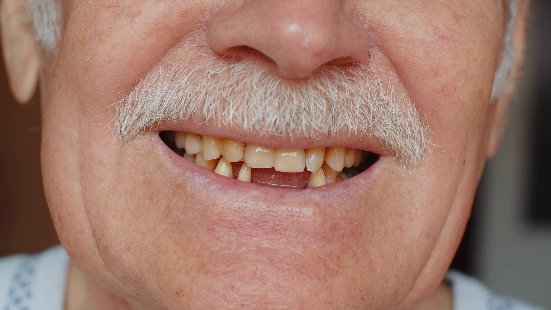 Toothless Male Smile Mouth Of Senior Elderly Stock Footage SBV ...
