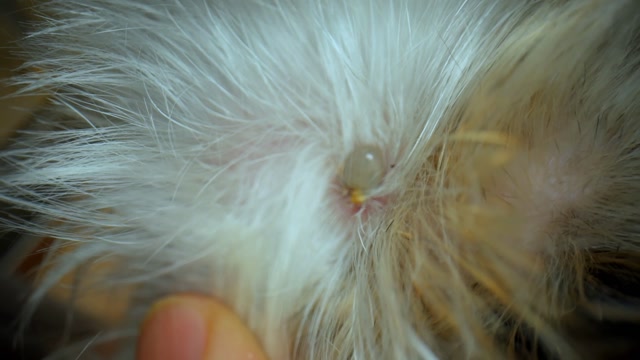Skin Parasite Removal Stock Footage: Royalty-Free Video Clips - Storyblocks