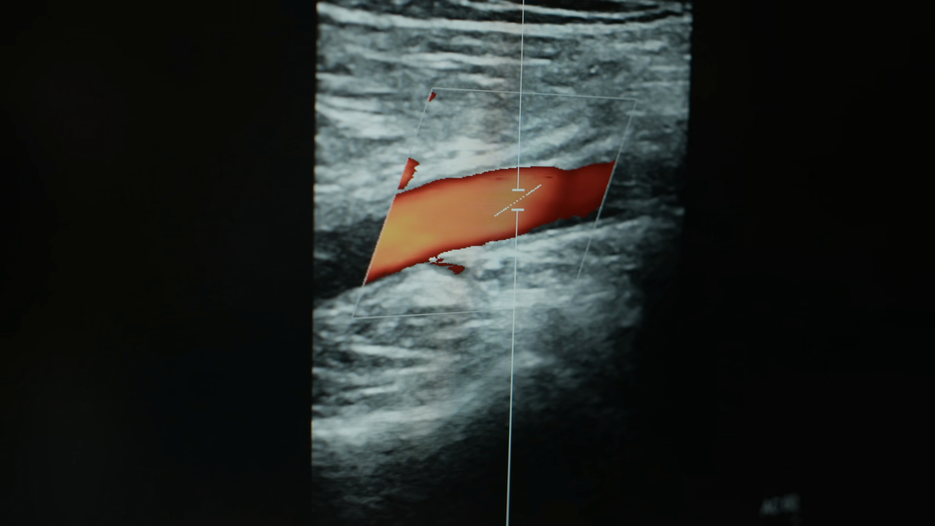 Close Up People Shot Of Ultrasound Machine Stock Footage SBV-353974024 ...