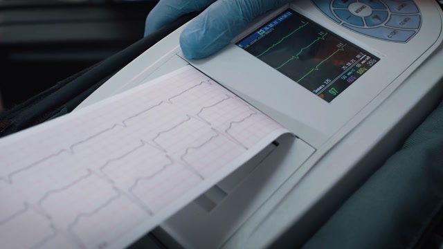 Heart Attack Machine Stock Footage: Royalty-Free Video Clips - Storyblocks