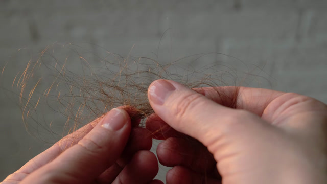 Woman Hair Loss Stock Footage: Royalty-Free Video Clips - Storyblocks